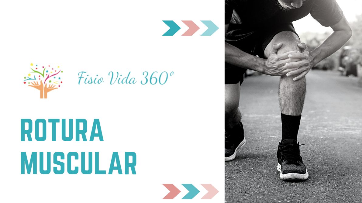 Rotura muscular | FisioVida 360