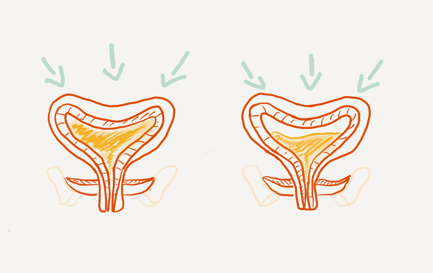 VEJIGA HIPERACTIVA | FisioVida 360
